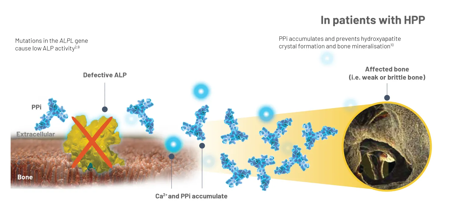 About HPP and Low ALP | HPP | Unify Rare